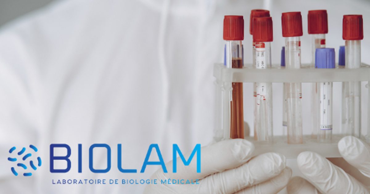 DVO | Gimv verkoopt aandeel Biolam terug aan management