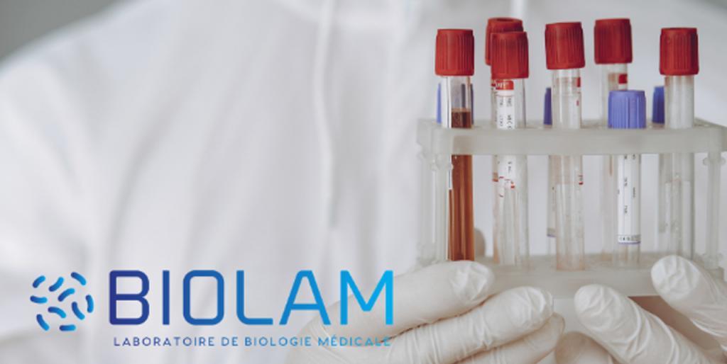 DVO | Gimv verkoopt aandeel Biolam terug aan management